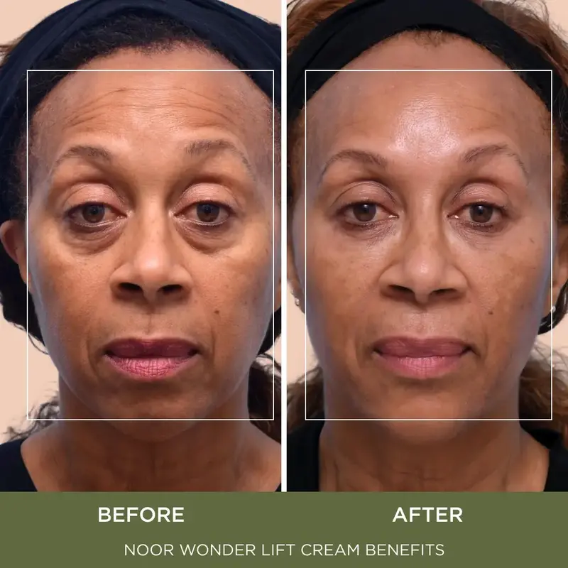 Noor WonderLift Cream